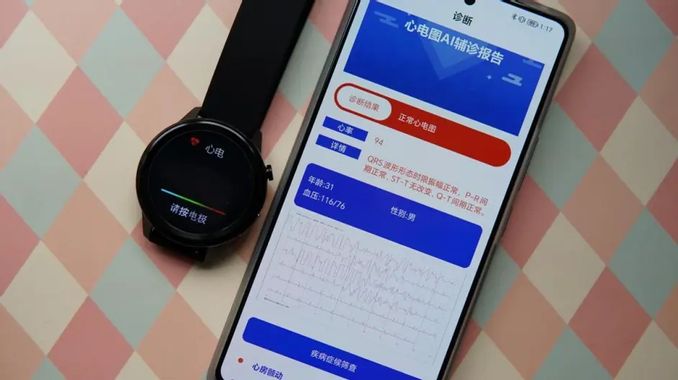 dido E55 Pro MAX智能手錶監測血糖心電血壓，堪稱全能健康管家